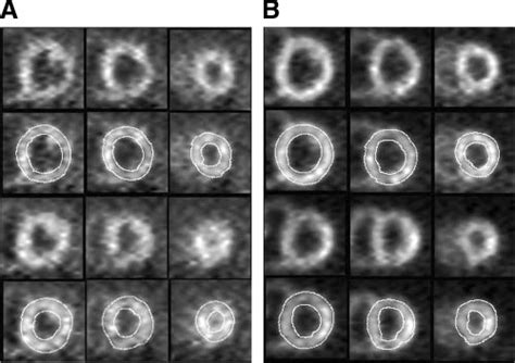 example of model based parameter estimation of cardiac geometry