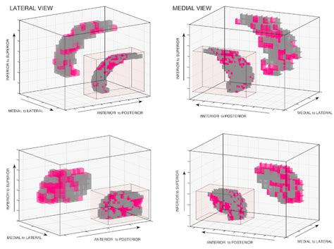 Main Boxes Show 3d Voxel Space Representation Of Left Hemisphere Download Scientific Diagram