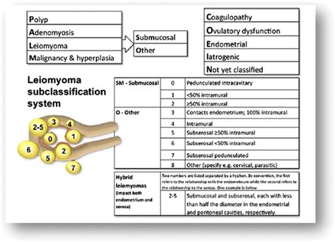 Figo Classification Of Fibroids Used With Permission From Munro M G [75] Download