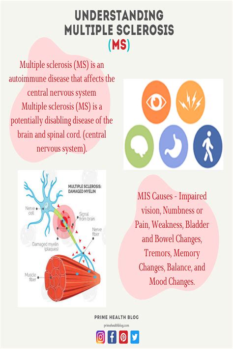 Identifying The First Signs Of Multiple Sclerosis MS