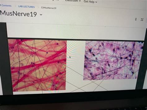 Lab Quiz Photos Flashcards Quizlet Lab Quiz Photos Flashcards Quizlet