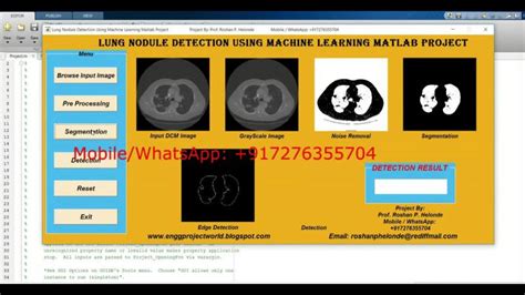 Prof Roshan Helonde On Linkedin Lung Nodule Segmentation Using Machine Learning Lung Nodule