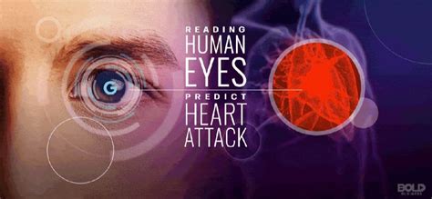 Sadik Shaikh On Linkedin Machinelearning Artificialintelligence Health Algorithms