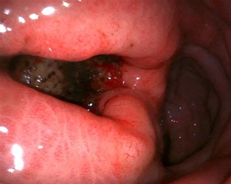 On Demand Webinar Beginners Guide To Small Animal Upper