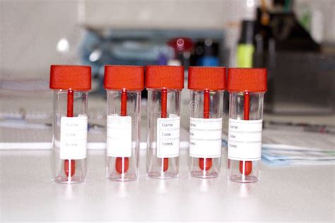 Medical Containers Stock Photo Image Of Sample Equipment