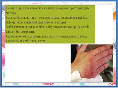 Невідкладна домедична допомога Види і наслідки кровотеч Невідкладна допомога при кровотечах