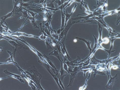 内皮细胞血管内皮细胞人原代内皮细胞思泰默细胞