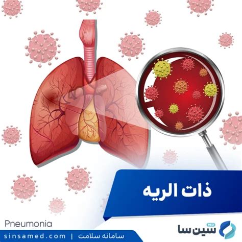 تب علل بروز، نشانه ها، روش تشخیص و درمان