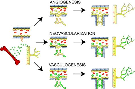 neovascularization in the eye and elsewhere occurs by both download scientific diagram