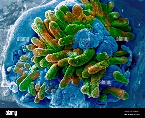 Small Intestine Coloured Scanning Electron Micrograph Sem Of A Biopsy From The Small