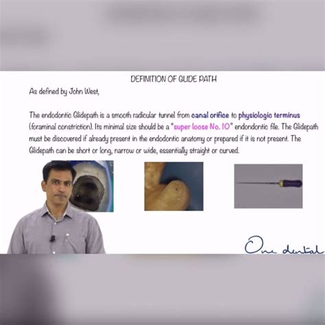 What Is A Glide Path One Dental Is The Biggest Online Platform For Dentistry