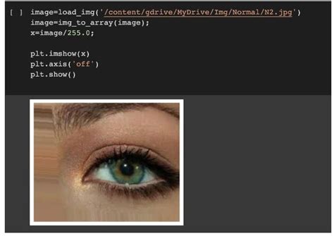 Implementing Vgg 16 Using Pre Trained Model Shiksha Online