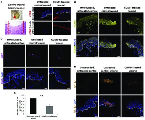 comp has a negative effect on keratinocyte proliferation and is