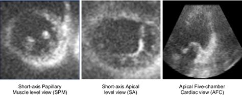 Figure 4 From Towards Autonomous Robotic Ultrasound Scanning Using The Reinforcement Learning