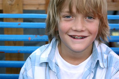 Orthodontic Evaluations Snodgrass King Orthodontics