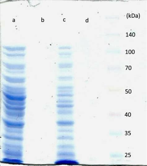 Sds Page Prset Emgfp Hpv52 L1 The Size Of Protein Of Interest Is 48 Download Scientific