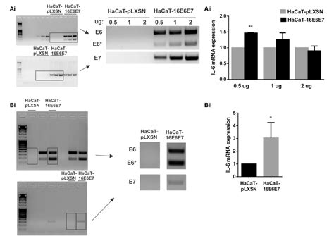 Figure 1 From E6 E7 And E6 From Hpv16 And Hpv18 Upregulate Il 6