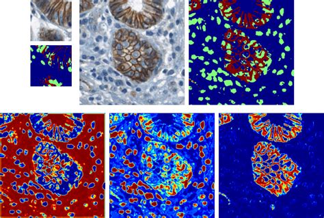 Examples Of The Segmentation Of A Histopathological Tissue Sample The