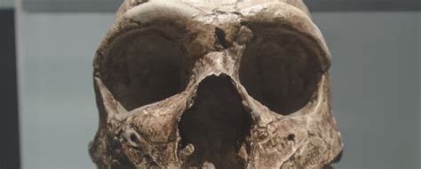Brain Abnormality In Modern Humans Linked To Ancient Neanderthal Dna Sciencealert