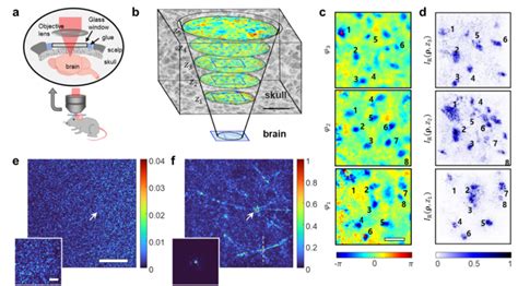 In Vivo Imaging Of A Mouse Brain Of A Matured Mouse Through The Intact Download Scientific