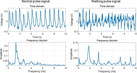 Comparison Between Normal And Noise Signals Download Scientific Diagram