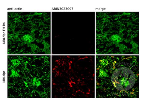 Complement Factor H Antibodies