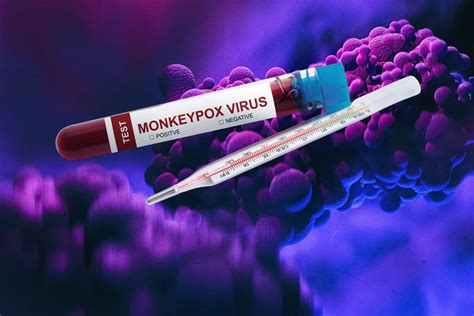 Monkeypox Case Confirmed At High School In Killeen Texas