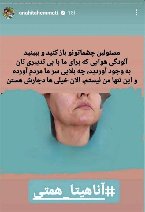 عکساستوری نرگس خانه به دوش درباره بیماری عجیبش