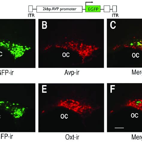 Stereotaxic Microinjection Of Aav Vectors Into The Supraoptic Nuclei Download Scientific