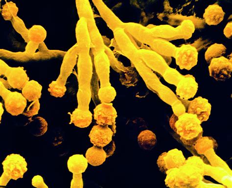 Scopulariopsis Brevicaulis Fungus By Science Photo Library