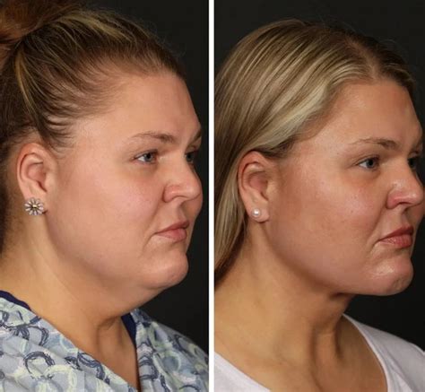 12 луѓе кои мораа да направат пластична операција и животот одеднаш им стана поубав