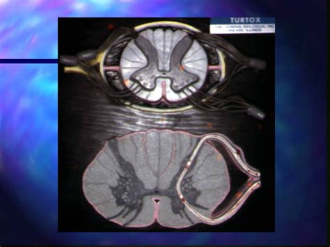 Spinal Column Diagram Diagram Quizlet
