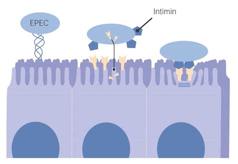 Escherichia Coli Concise Medical Knowledge