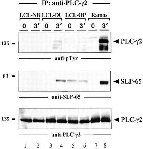 Block Of Plc γ2 Phosphorylation In Lcls Antiplc γ2 Immunoprecipitates