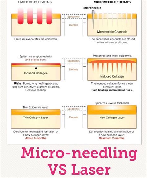 Microneedling Vs Laser Skin Resurfacing Infographic