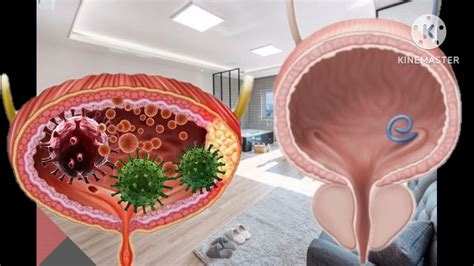 오줌 애니메이션 위생주의 음식먹지마세요 스킵가능 이거로할겁니다 Youtube