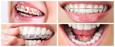 თქვენი ორთოდონტი თამარ კაკაბაძე Your Orthodontist Tamar Kakabadze