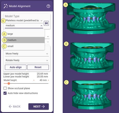 Model Creator Module Exocad