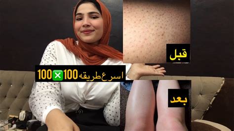 تخلصي من جلد الوزه نهائياً 👍🏻 Youtube