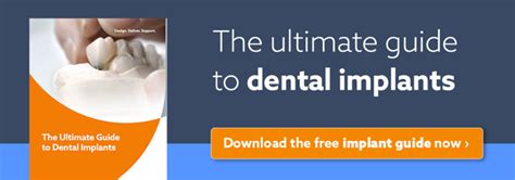 Oral Bisphosphonates And Dental Extractions Guidelines