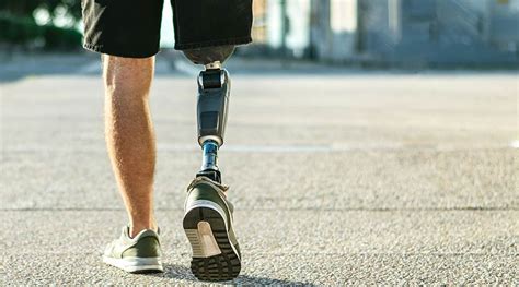 Rehabilitation Of Lower Limb Amputee