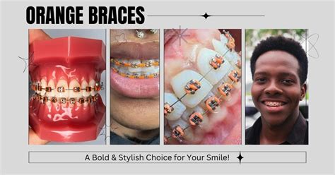 Orange Braces A Bold Stylish Choice For Your Smile Toothcareusa Com