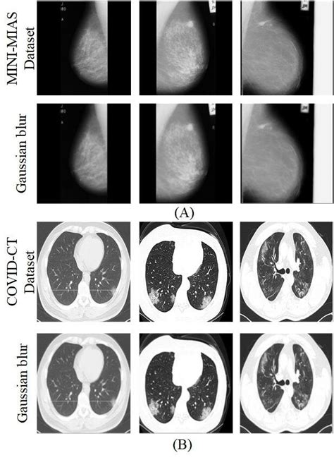 Mammography And Chest Ct Scan Images Preprocessing Source Mini Mias Download Scientific