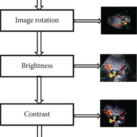 Flow Chart And Example Of Auxiliary Algorithm For Ultrasonic Image Download Scientific Diagram