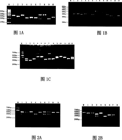 Primer For Detecting Pathogenic Microorganism And Multiple Pcr Using The Same Eureka Patsnap