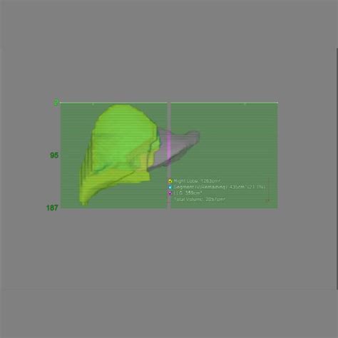 Stanford 3d And Quantitative Imaging Laboratory On Linkedin Radiology