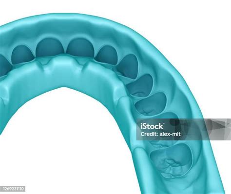 모형 치과 키 치료 계획 의학적으로 정확한 치아 3d 일러스트레이션 보철 장비에 대한 스톡 사진 및 기타 이미지 보철 장비 건강관리와 의술 계획 Istock