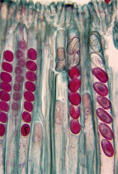 17 Inspirasi Ascospores Fungi