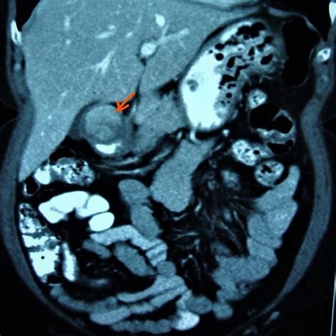 Neuron Specific Enolase Download Scientific Diagram