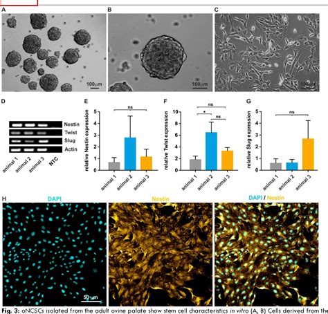 Figure 3 From Leveraging Human Oral Derived Neural Crest Derived Stem Cell Homing Honcscs